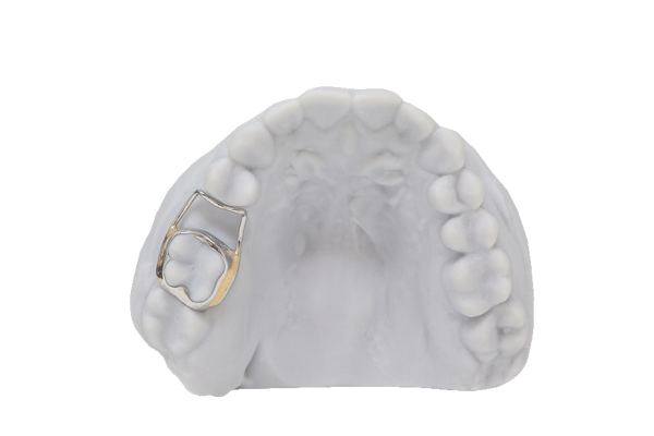 Cast Space Maintainer RDL | Russellville Dental Lab