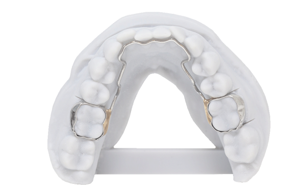 Lingual Arch Space Maintainer RDL | Russellville Dental Lab