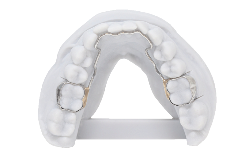Lingual Arch Space Maintainer RDL | Russellville Dental Lab