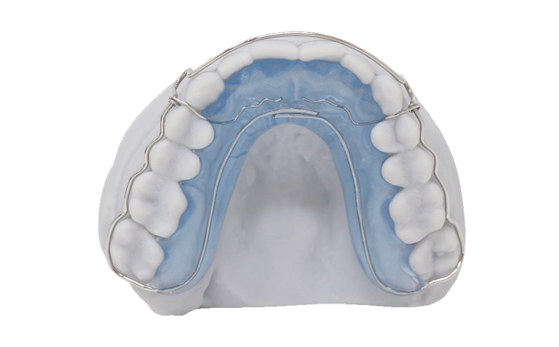Modified Begg Retainer RDL | Russellville Dental Lab