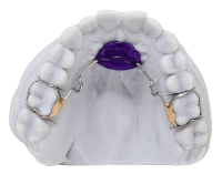 Nance Appliance | RDL | Russellville Dental Lab