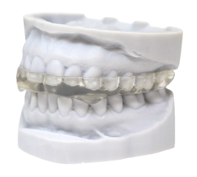 Hard Occlusal Splint RDL | Russellville Dental Lab