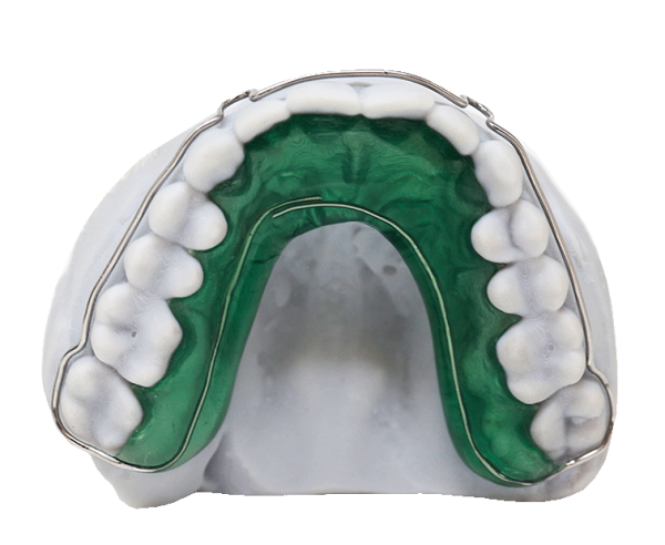 Standard Begg Retainer RDL | Russellville Dental Lab