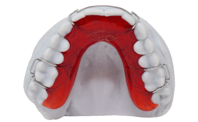 Hawley Retainer RDL | Russellville Dental Lab