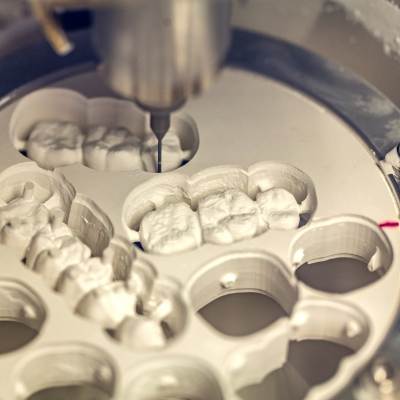 New Crown Under Existing Partial Denture Workflow RDL | Russellville ...