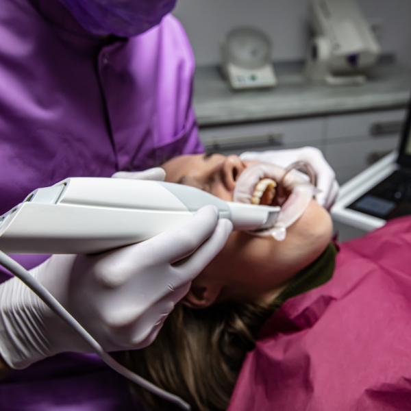 Optimizing Scanning Workflow: Key Steps with 3Shape TRIOS for Full Arch ...