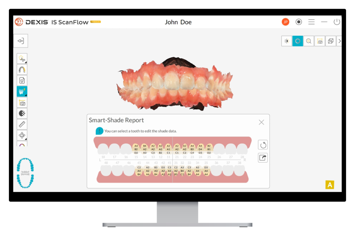 Dexis IS 3800 Scanner RDL | Russellville Dental Lab