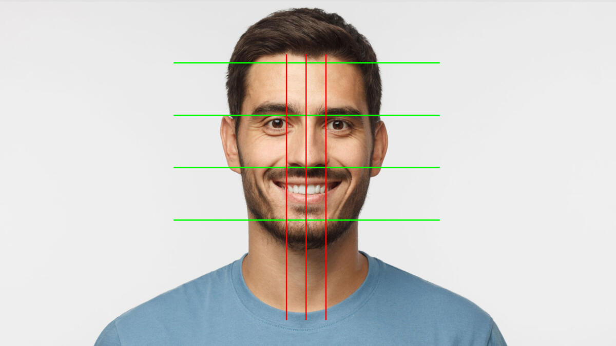 Mastering Facial Proportions in Dentistry for Aesthetic Excellence RDL ...