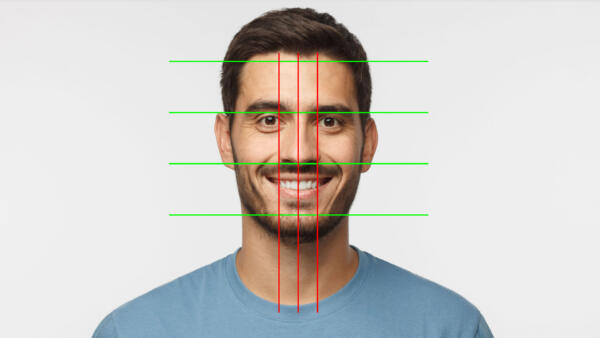 Mastering Facial Proportions in Dentistry for Aesthetic Excellence RDL ...
